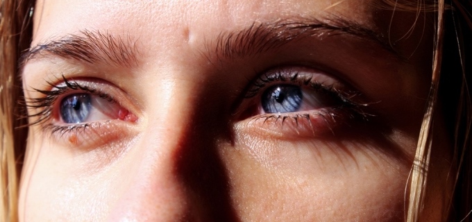 Give Your Weary Eyes a Boost with Six Easy Exercises - Connect ...